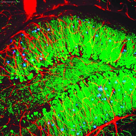 Computational Modeling In Neuroscience Paris Brain Institute