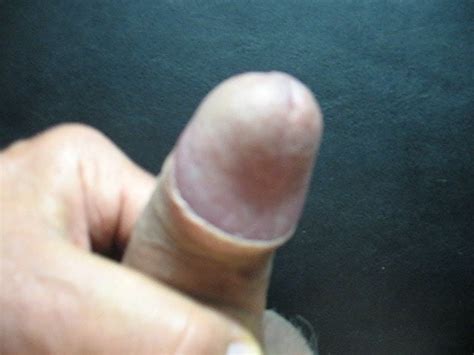 Free Foreskin Wank Gay Porn Videos Xhamster