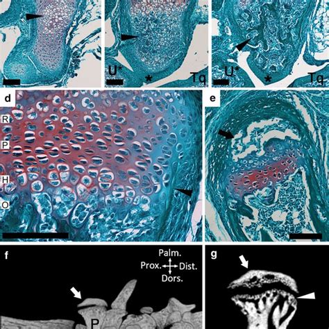 Comparison Of Pisiform And Calcaneus Ossification Patterns In Humans Download Scientific