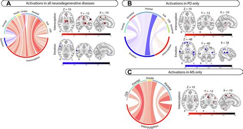 Neuroimaging Metanalyses Reveal Convergence Of Interoception Emotion And Social Cognition