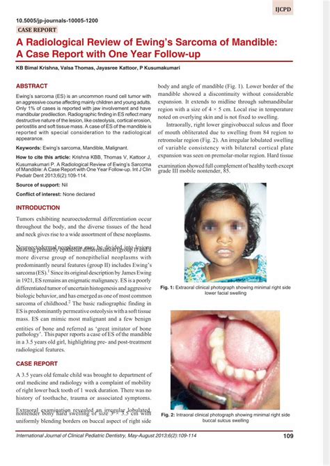 Pdf A Radiological Review Of Ewings Sarcoma Of Mandible A Case Report With One Year Follow