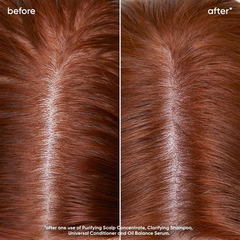 Scalp Sync Oil Balancing Serum Biolage Professional