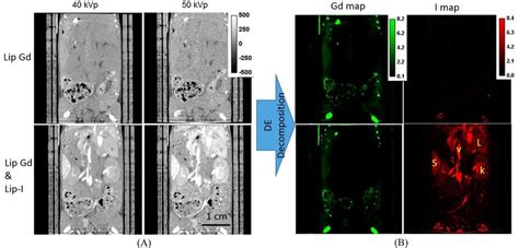 A Matching Coronal Slices Through The In Vivo Dual Energy Micro CT Download Scientific