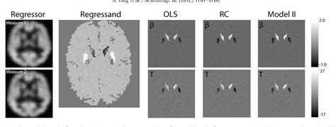 Figure 1 From Biological Parametric Mapping Accounting For Random Regressors With Regression