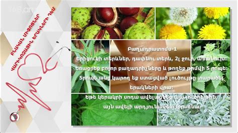 Բնական միջոցներ վարիկոզային երակների դեմ Youtube