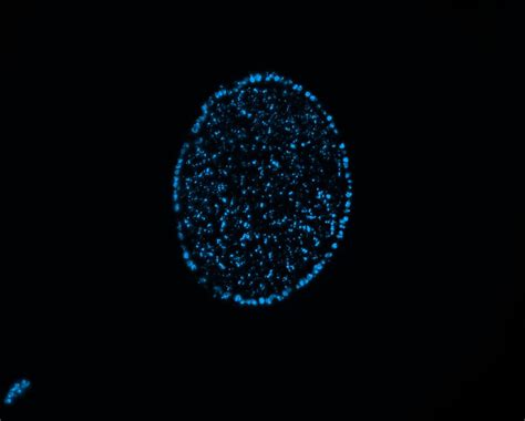 How To Crop A Ring Shape Composite Selection In Imagej Image