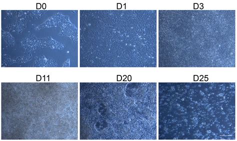 Directed Dopaminergic Neuron Differentiation From Human Pluripotent Stem Cells
