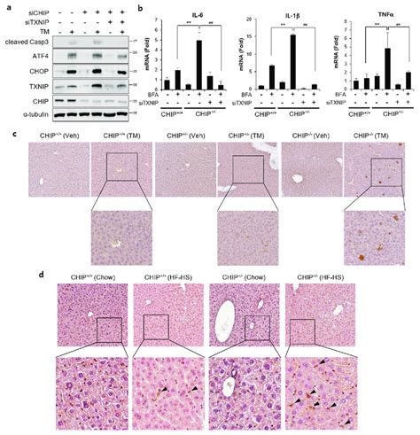 Chip Mediated Txnip Regulation Is Responsible For Er Stress And Download Scientific Diagram