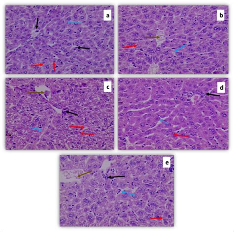 Histological Liver Sections Of The Following Groups A Vitamin C 100