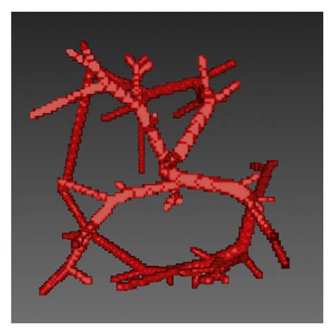 Segmentation Of Vessel From Synthetic Data By Using The Improved Fuzzy