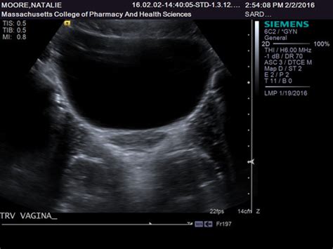 Lab Exam Review Flashcards Quizlet