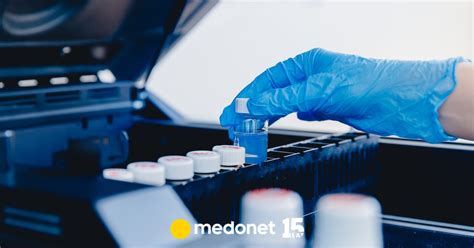 Lekarz Krad Sperm Swoich Student W Afera Wysz A Na Jaw Przez Przypadek Medonet