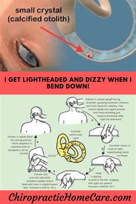 40 Großartig Bild Inner Ear Maneuver Epley Maneuver For Right Side
