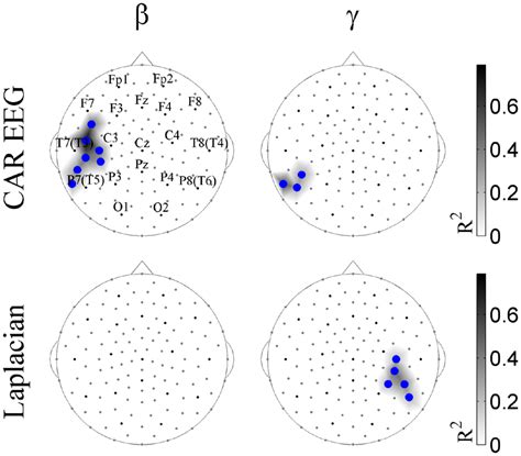 Surface Topography Of Correlations Between Mps And Liddles Factor Of