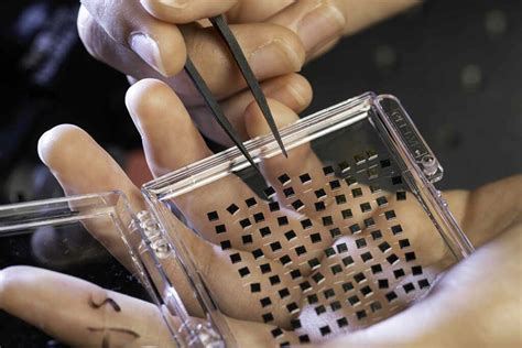 What Are Intraocular Lenses And How Can They Restore Sight For Patients With Cataracts