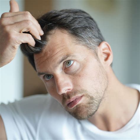 Hair Loss Causes In Men Hair Restoration Turkey