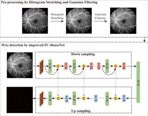 figure 1 from an automatic detection model of microaneurysms based on