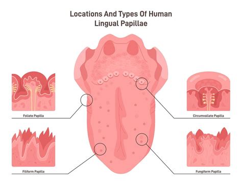 Papiloma Humano Vectores Iconos Gráficos Y Fondos Para Descargar Gratis