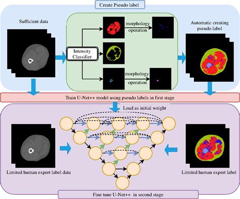Label Efficient Segmentation Of Single Slice Thigh Ct With Two Stage Pseudo Labels