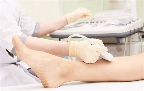 Vascular Ultrasound Of Legs