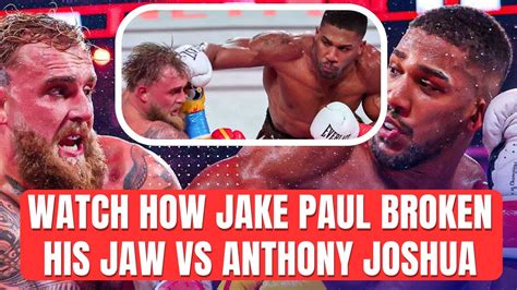 Watch How Jake Paul Broken His Jaw Vs Anthony Joshua Post Fight