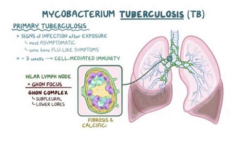 Mycobacterium Tuberculosis Complex Mtbc Detection Rt Pcr Kit At ₹ 22000 Piece Pcr Kit In
