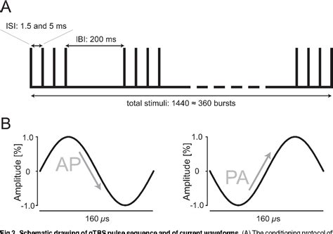 Figure 2 From Quadri Pulse Theta Burst Stimulation Using Ultra High Frequency Bursts A New