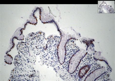 Dab Quantification Qupath Image Analysis Imagesc Forum