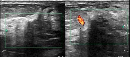 Radiology Quiz 21256 Radiopaedia Org