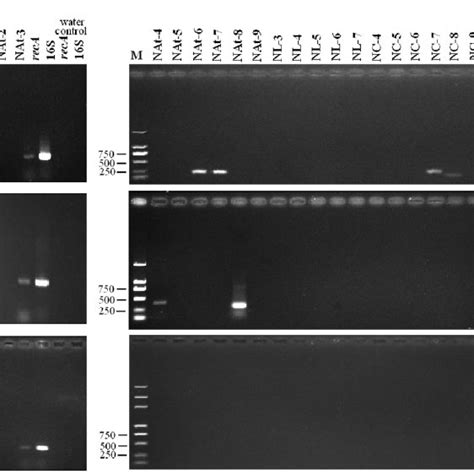 The Rt Pcr Results Of The Re Annotated No Coding Orfs A B And C Download Scientific Diagram