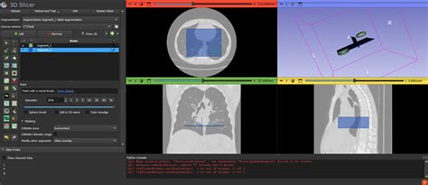 Cant Edit Segmentation Created From A Labelmap Outside A Box Support