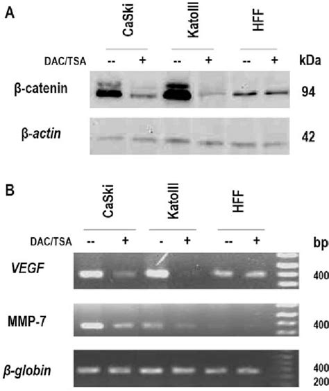 Figure 5 From Wnt β Catenin Pathway Activation And Silencing Of The Apc Gene In Hpv Positive