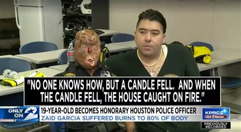 Teenager Who Survived Critical Burns Made Honorary Police Officer The