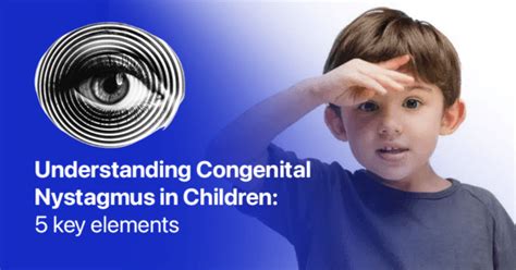 Vertigo And Nystagmus A Comprehensive Guide From A Neuro Ophthalmologist