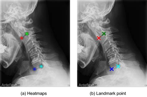 Most X Ray Had A Description Of The Posture In The Corner Of The X Ray Download Scientific