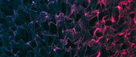 Genetic Defects Involved In Neuron Death Neuro Central