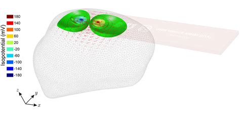 Representative Electrostatic Simulation For Measuring The Volume Download Scientific Diagram