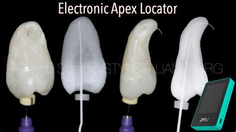 Electronic Apex Locator Style Italiano Endodontics