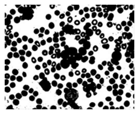 a binary image using thresholding b rbcs after removing the wbc s