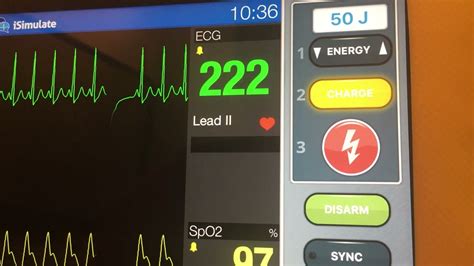 Sync Cardioversion Youtube