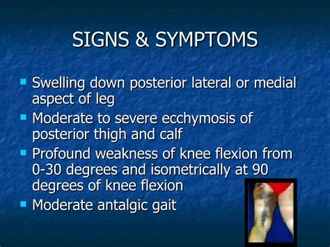 Hamstring Avulsion Repair Rehabilitation Ppt
