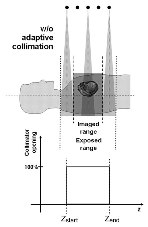 What Is Beam Collimation In Ct Scan At Eloise Rameriz Blog