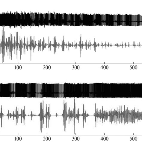 Transient Heart Upper Trace And Respiratory Lower Trace Rhythm
