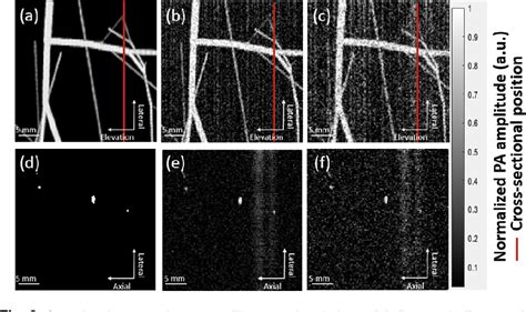 Figure 2 From Unsupervised Denoising Of Photoacoustic Images Based On