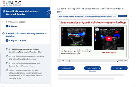 Vascular Ultrasound Course
