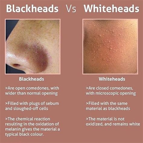 White Heads
