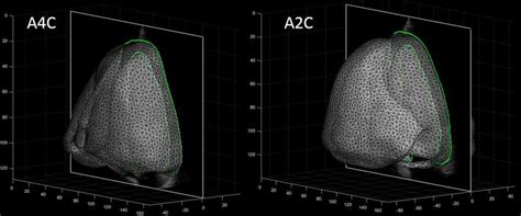 Result Of The 3d2d Registration Step Described In Sect Ii C After Download Scientific