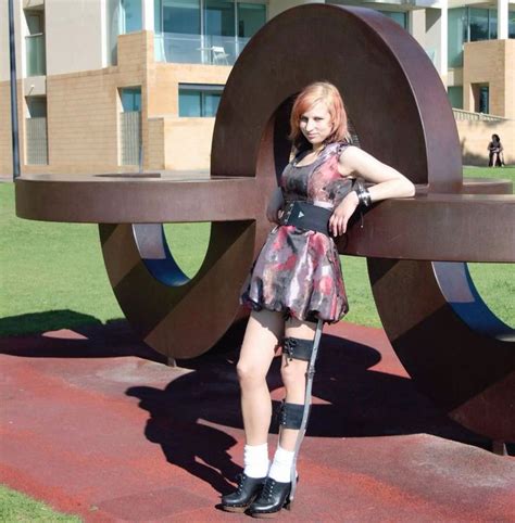 Pin By Martin Cargnelli On Orthopädie Disabled Women Leg Braces