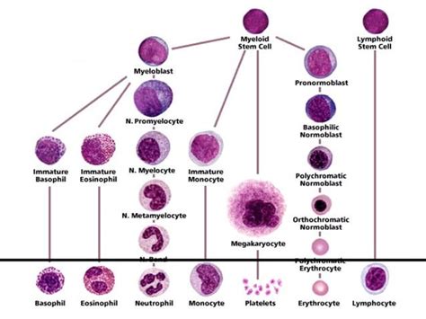 Acute Myeloid Leukemia Classification Pptx