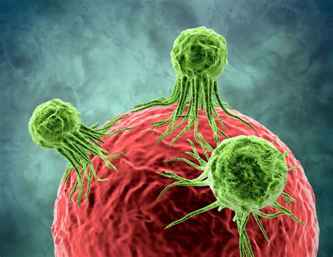 Mesothelioma Growth Rate Pintas And Mullins